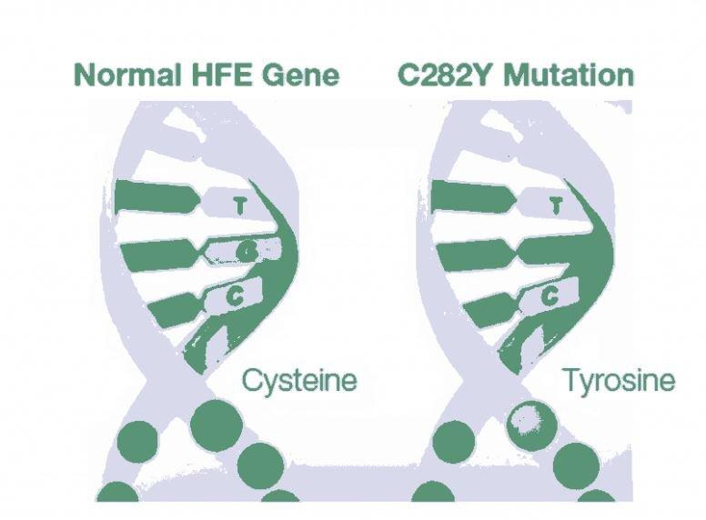 Gen hemochromatosis là gì và nó có di truyền không? - ChaoBacSi.org
